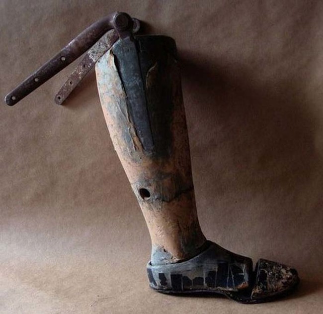 15 Vintage Medical Photos Will Make You Glad It’s 2015 – These Doctors ...