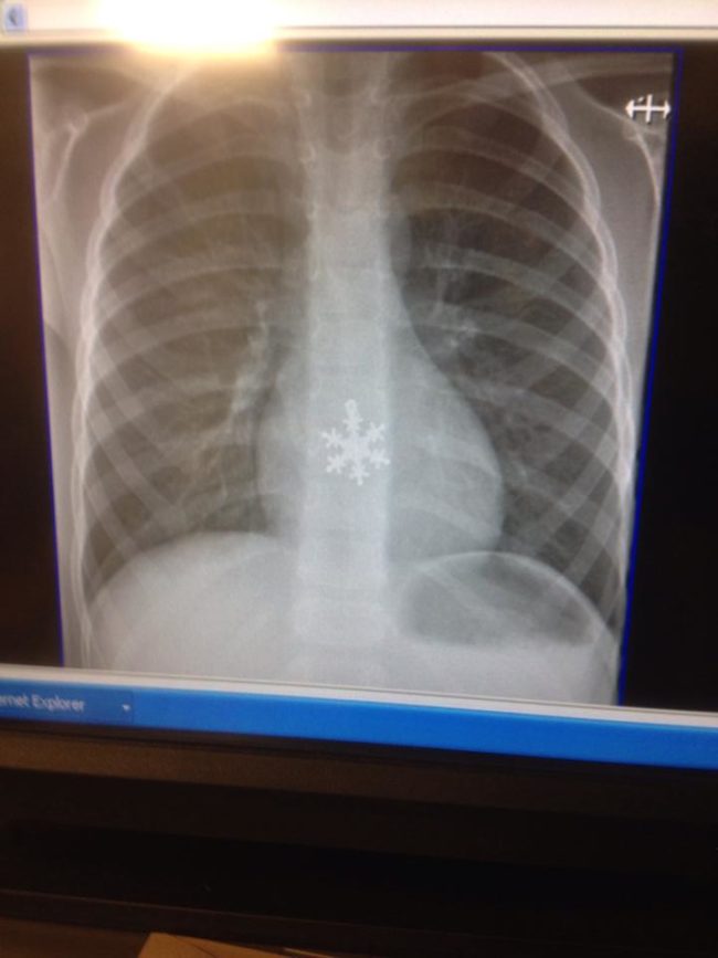 15 Crazy X-Ray Photos That Will Make You SO Thankful You’re Not A ...