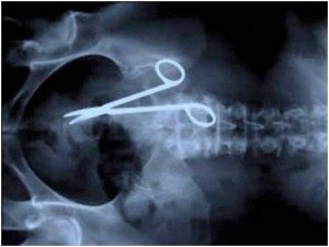 15 Crazy X-Ray Photos That Will Make You SO Thankful You’re Not A ...