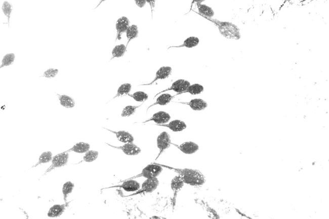 This Is The Experimental New Gel That Could Replace Vasectomies In The ...